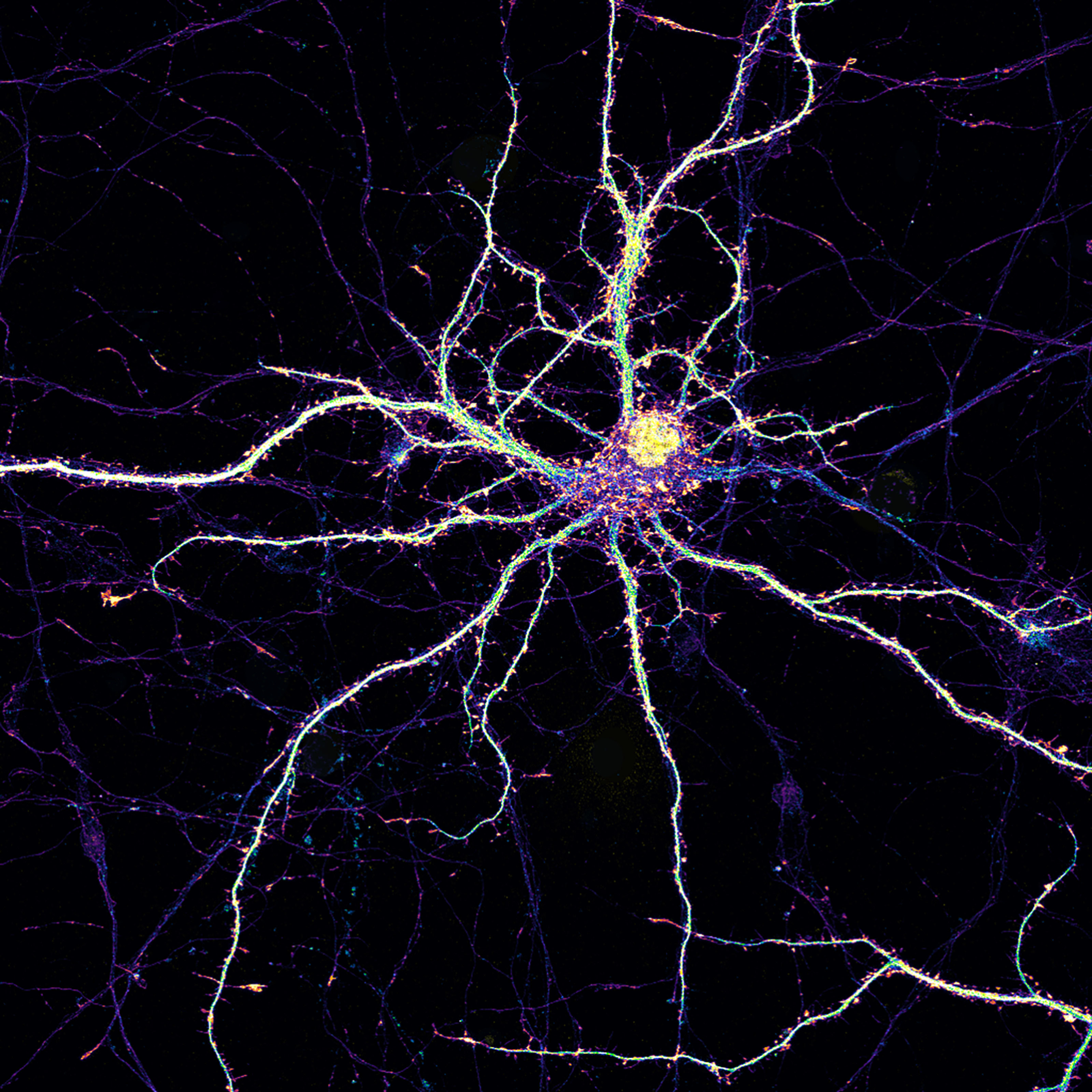 Maturing mouse cortical neuron in culture | Nikon Small World