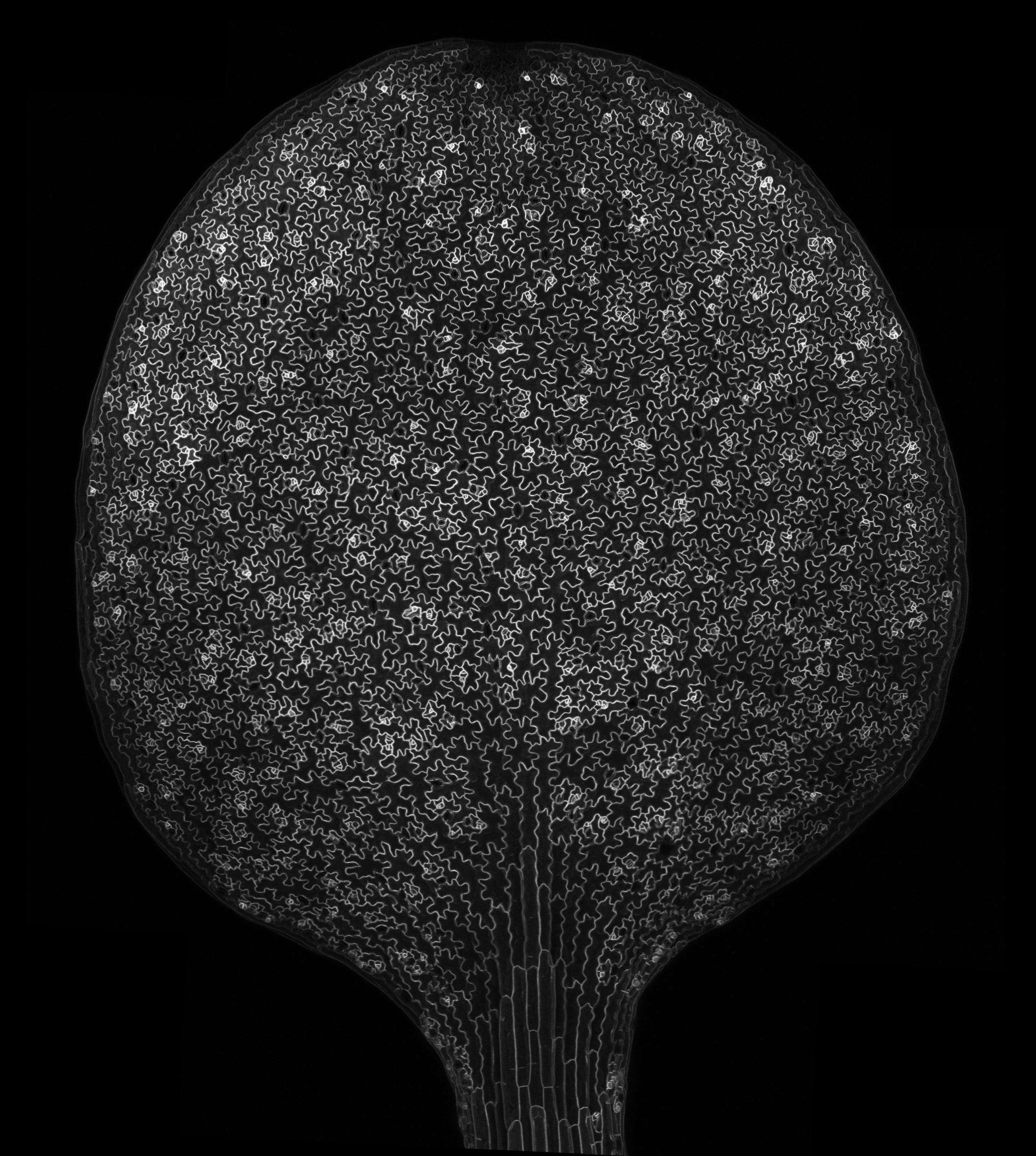 Embryonic leaf of Thale cress (Arabidopsis thaliana) | Nikon Small World