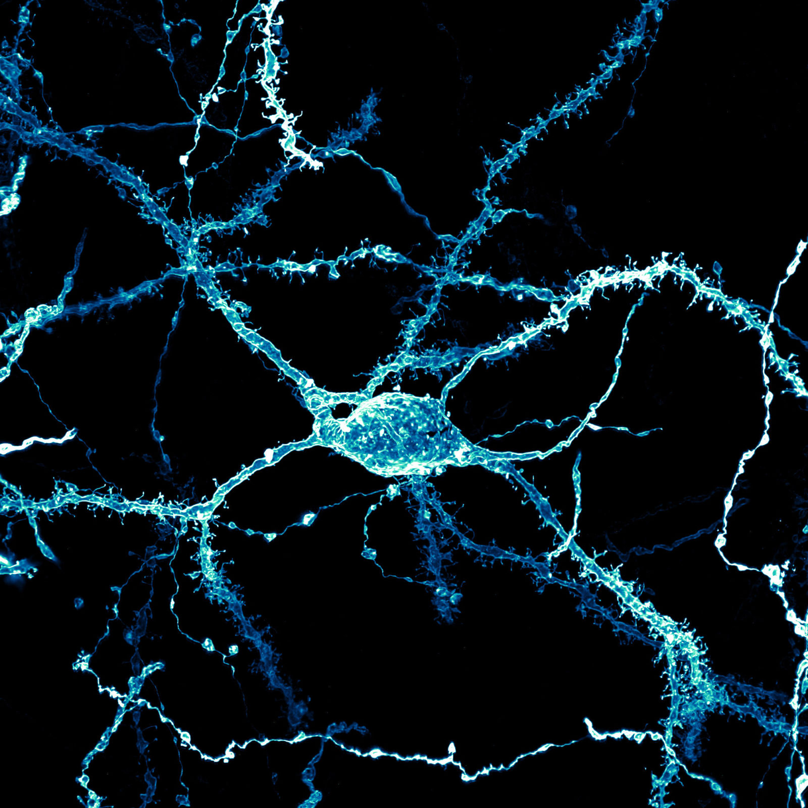 Neuron densely covered in dendritic spines from the striatum of an ...