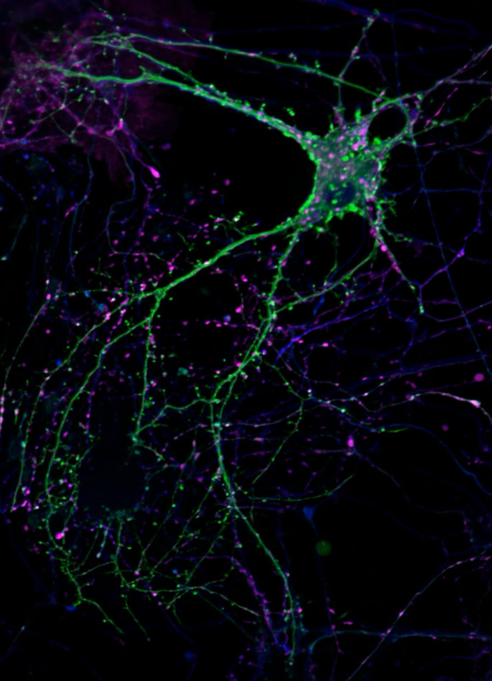 Live mouse neurons with fluorescently labeled points of connection ...