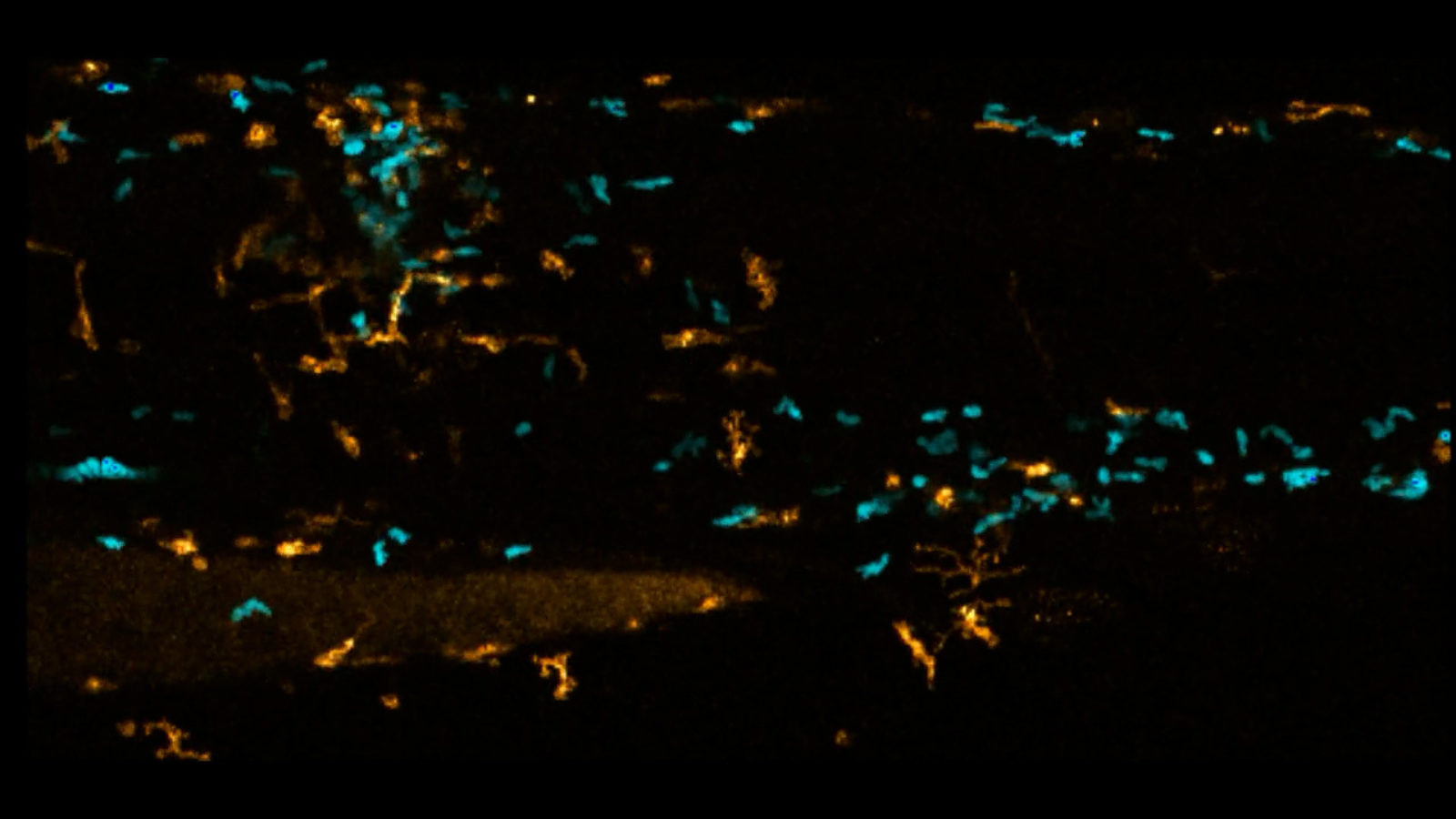 Immune response to spinal cord injury in zebrafish | Nikon Small World