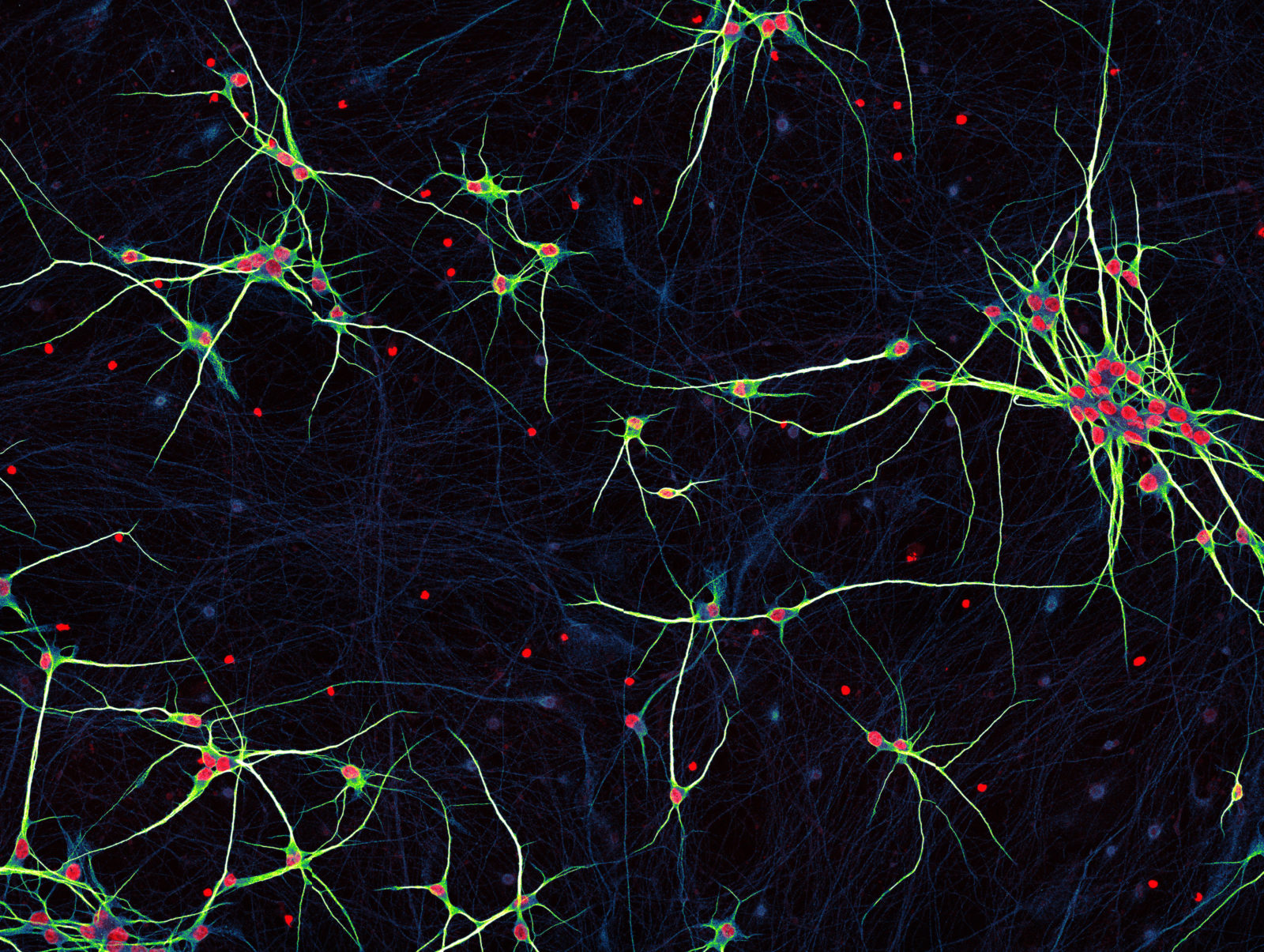 Human neurons | Nikon Small World