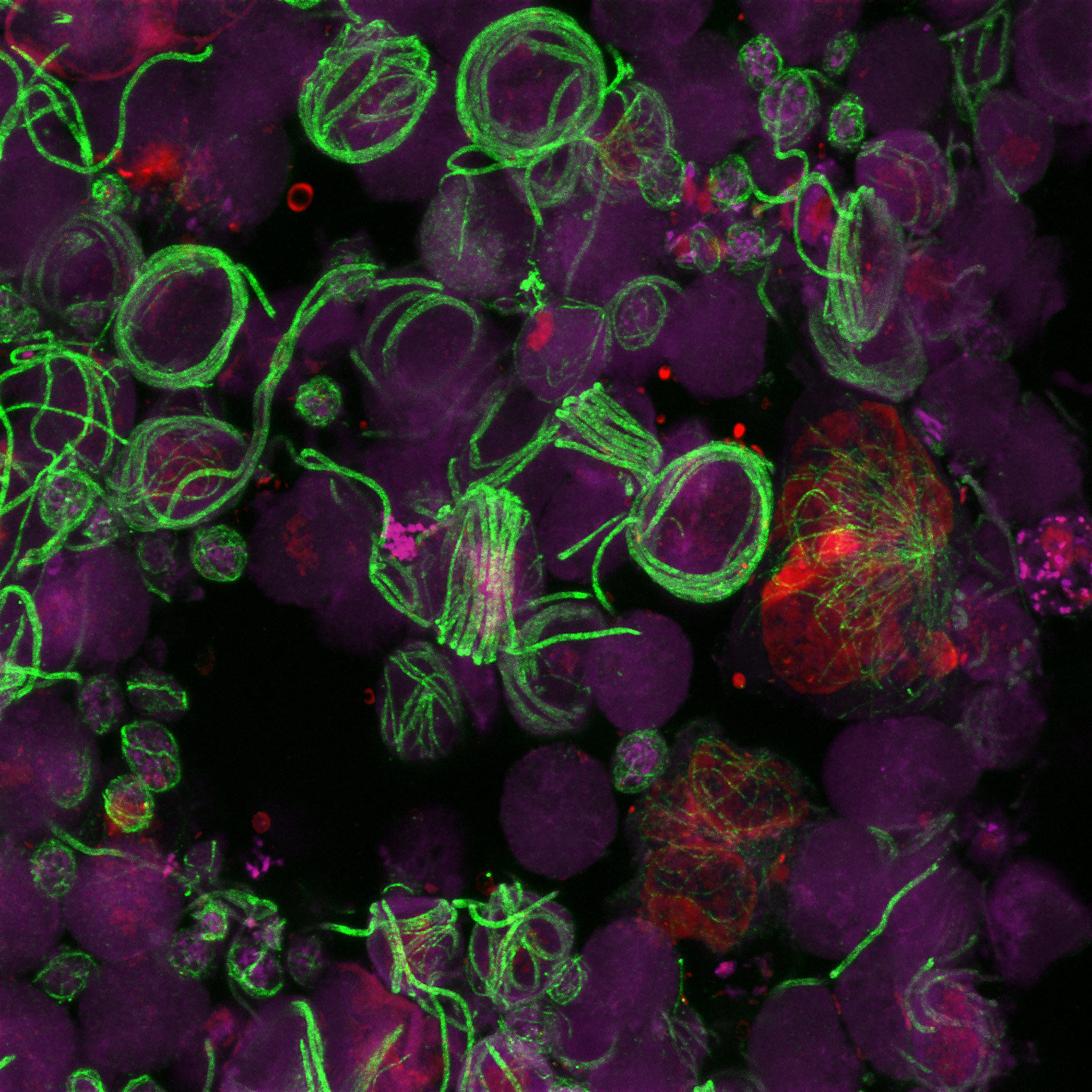 Malaria parasites and mouse blood cells | Nikon Small World