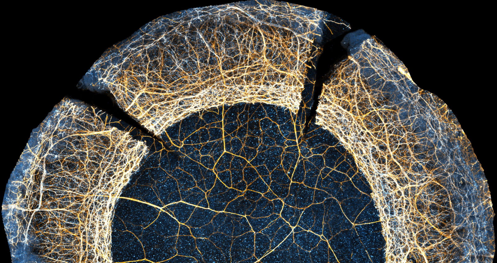 Neuronal axons connecting to the muscles of the iris and the cornea ...