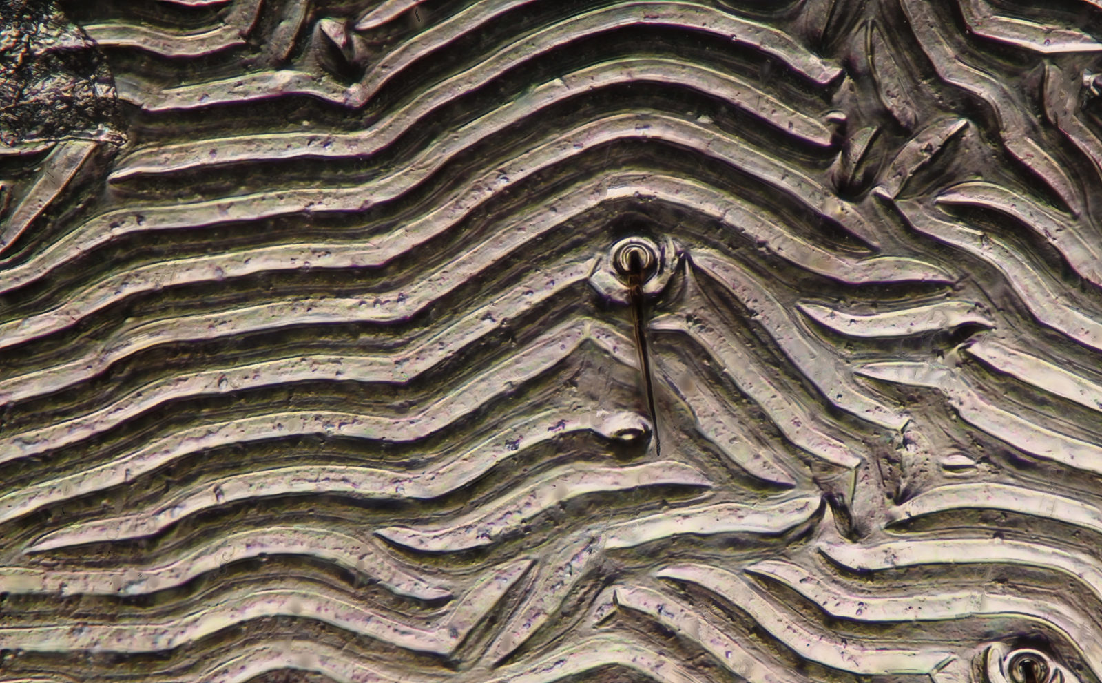 Abdominal skin of a tick engorged with blood | Nikon Small World