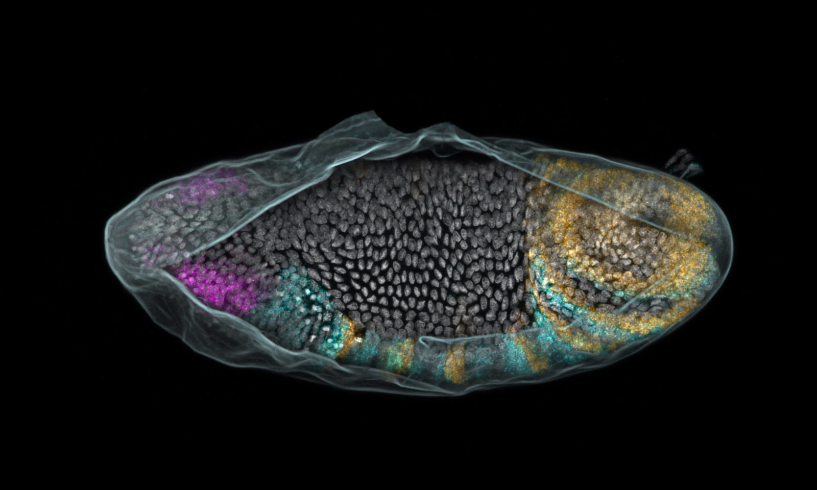 Gene expression patterns in a drain fly embryo | Nikon Small World