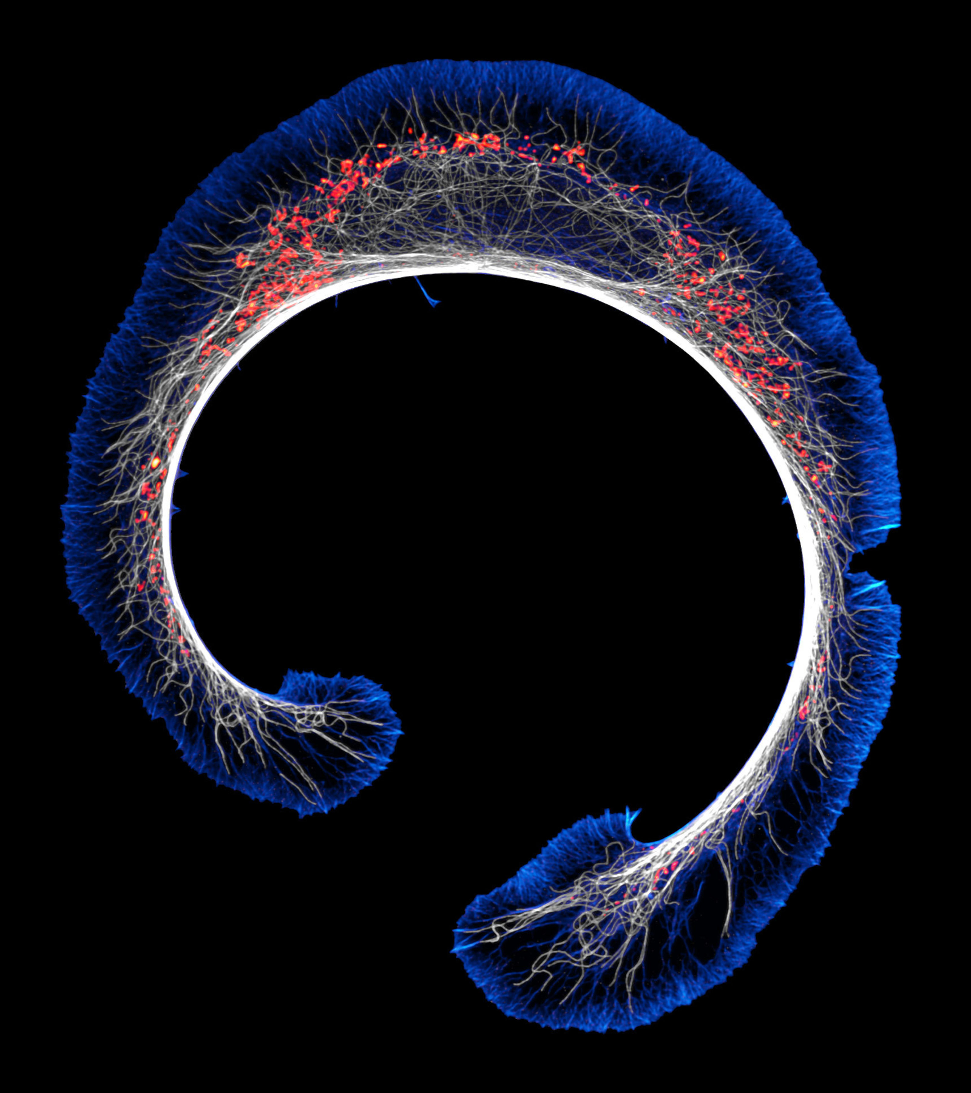 Early stage of mouse glioblastoma cell differentiation | Nikon Small World