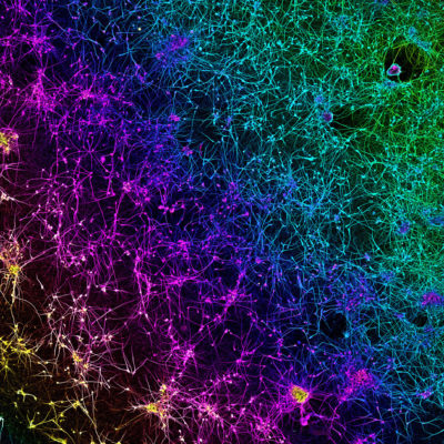 Network of dopaminergic neurons generated from human stem cells | Nikon ...