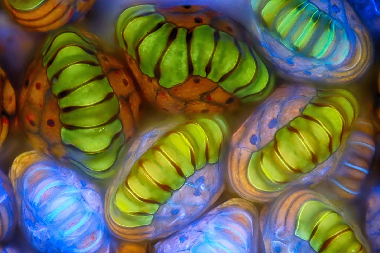 Spore sacs (sporangia) of a fern | Nikon Small World