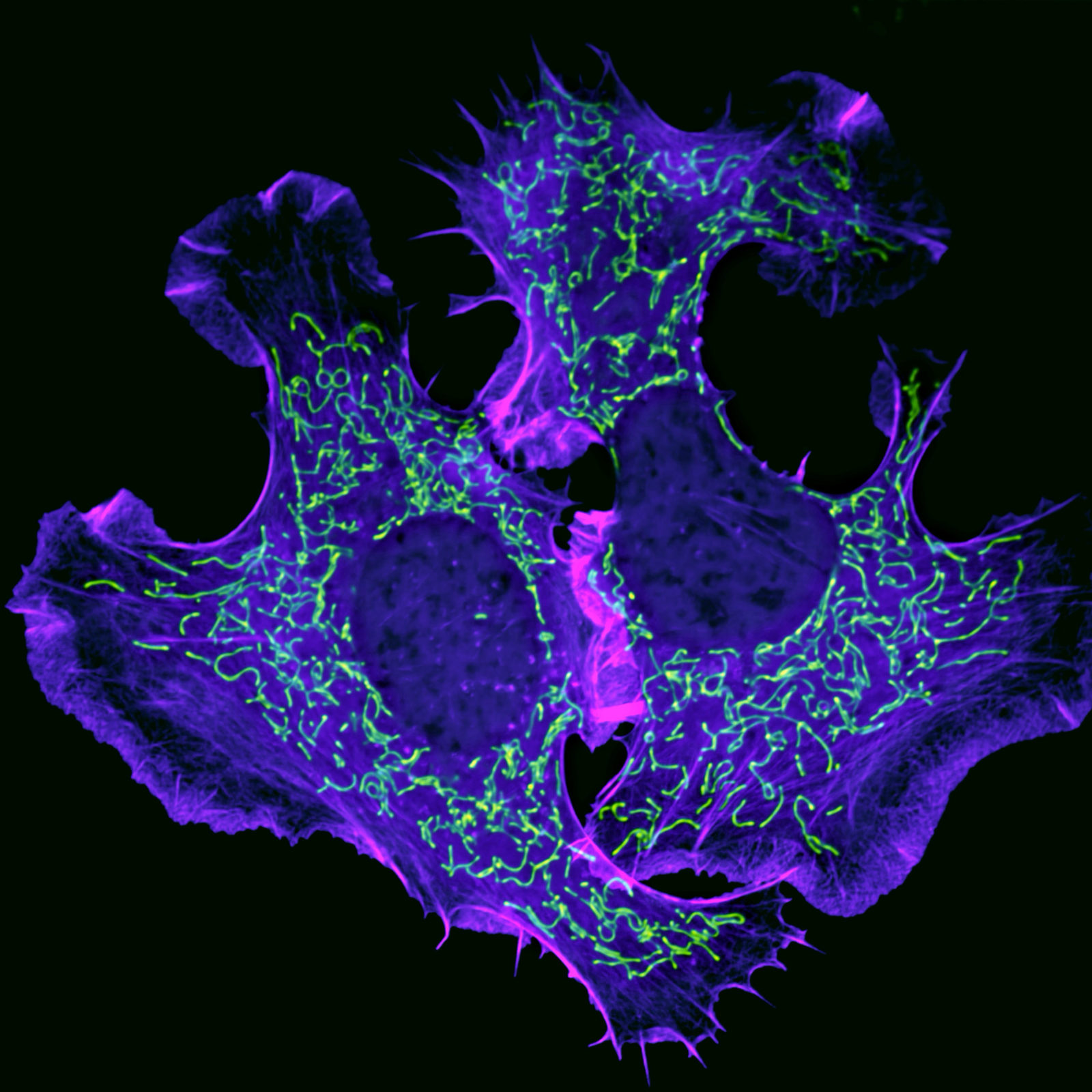 Actin and mitochondria in mouse brain tumor cells | Nikon Small World