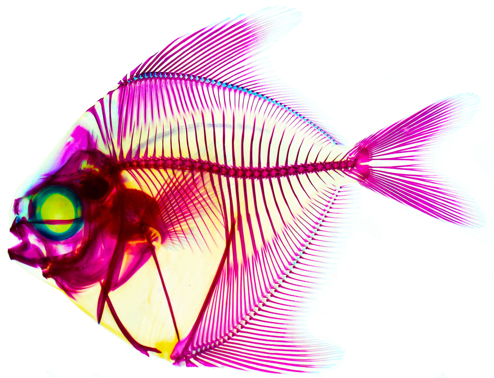 Histologically-stained harvestfish/star butterfish (Peprilus paru ...