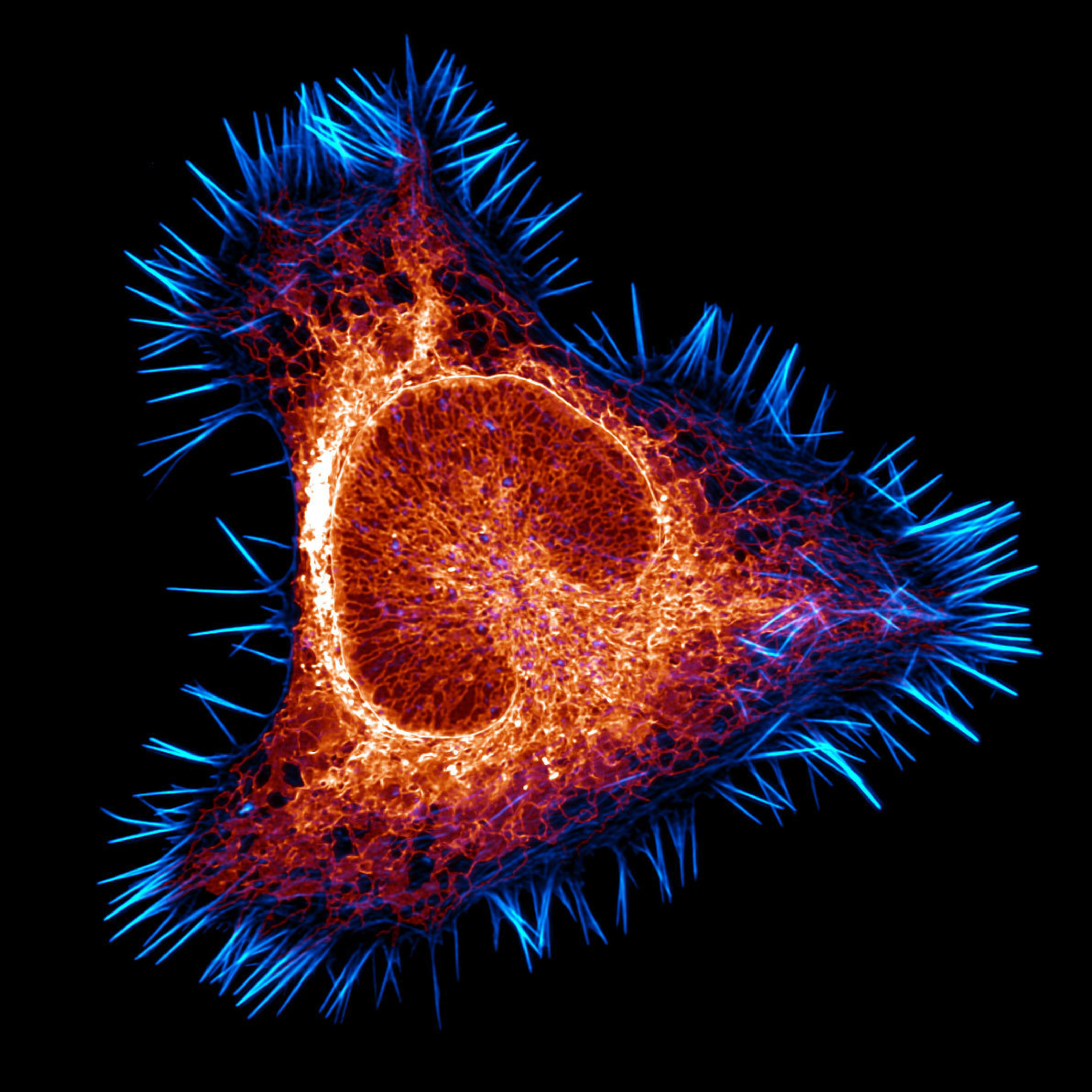The actin cytoskeleton (cyan) and endoplasmic reticulum (red) of a ...
