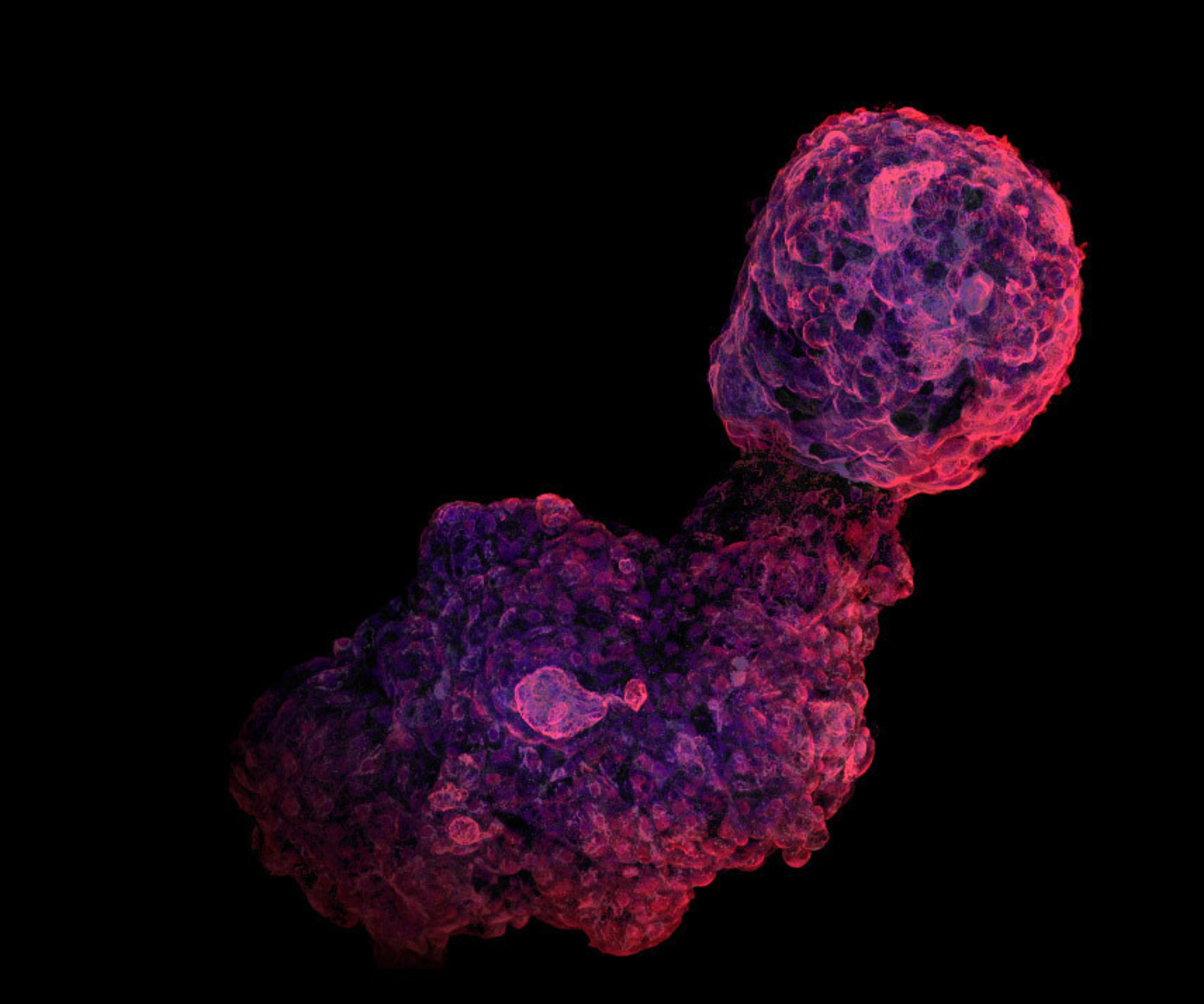 Human iPSC-derived cardiac organoid | Nikon Small World