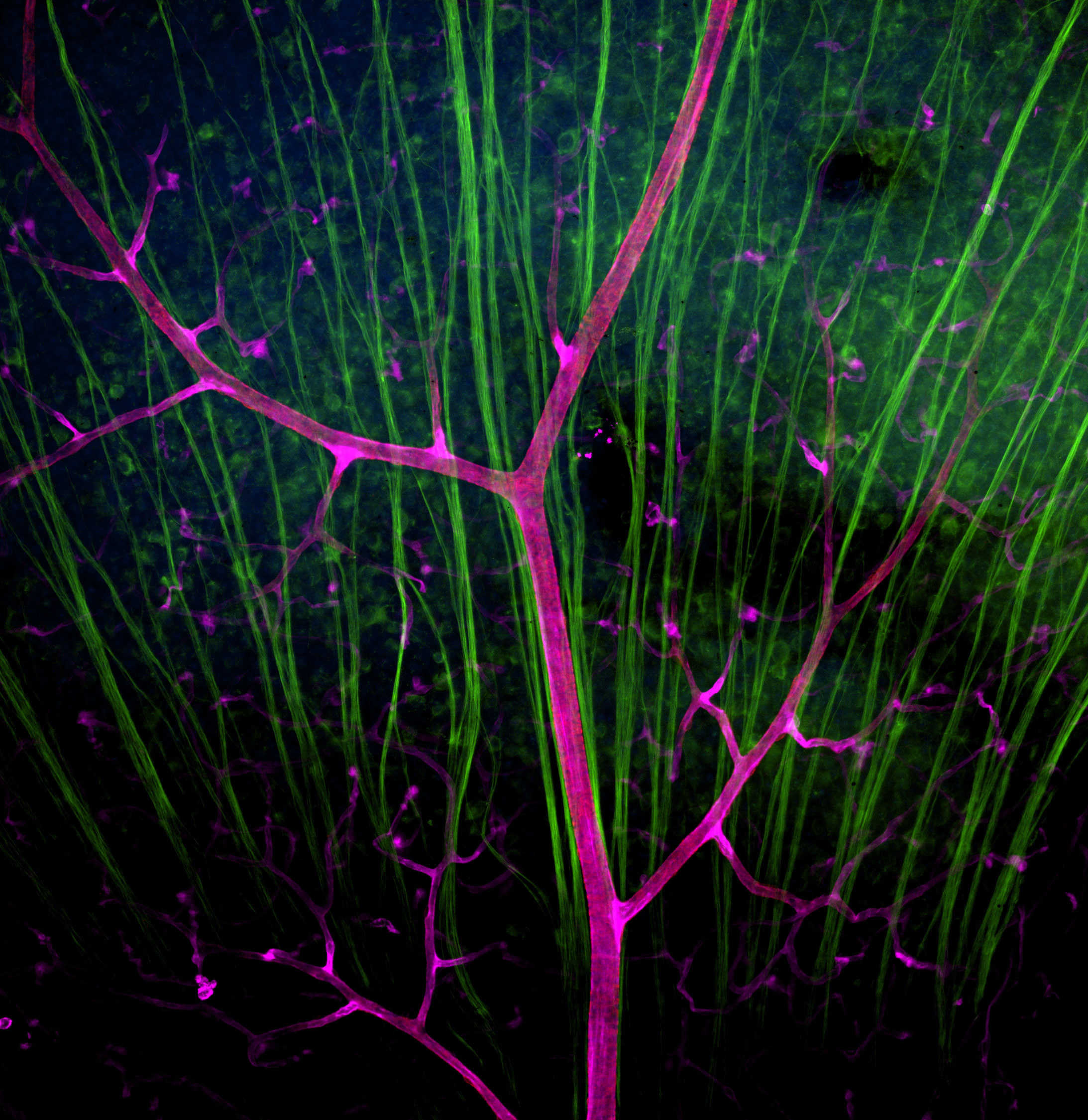 Mouse retina showing vasculature, nerve bundles and macrophages | Nikon ...