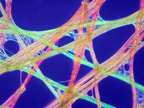 1980 Photomicrography Competition | Nikon’s Small World