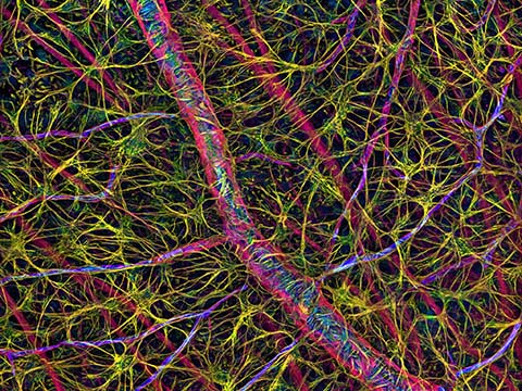 2006 Photomicrography Competition | Nikon’s Small World