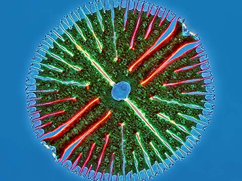 2013 Photomicrography Competition | Nikon’s Small World