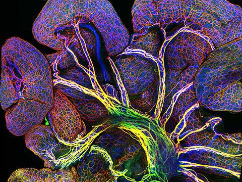 2019 Photomicrography Competition | Nikon’s Small World